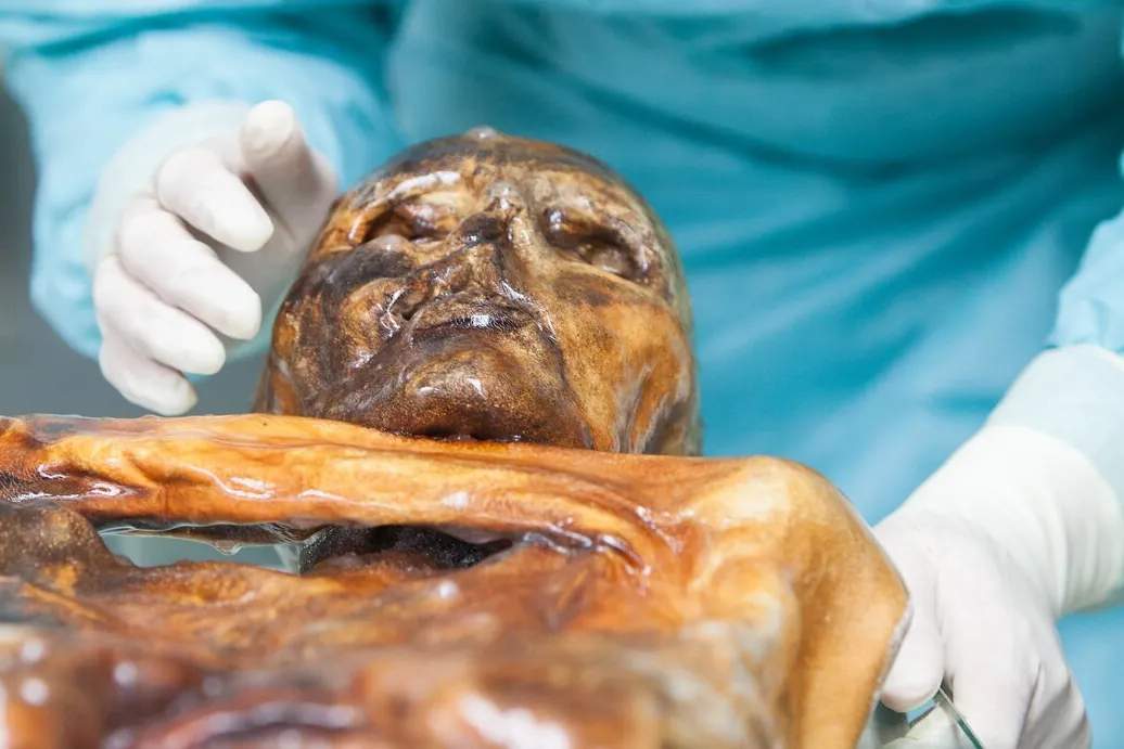 La momia de Özti, el hombre de hielo, es una despensa de microbios ...